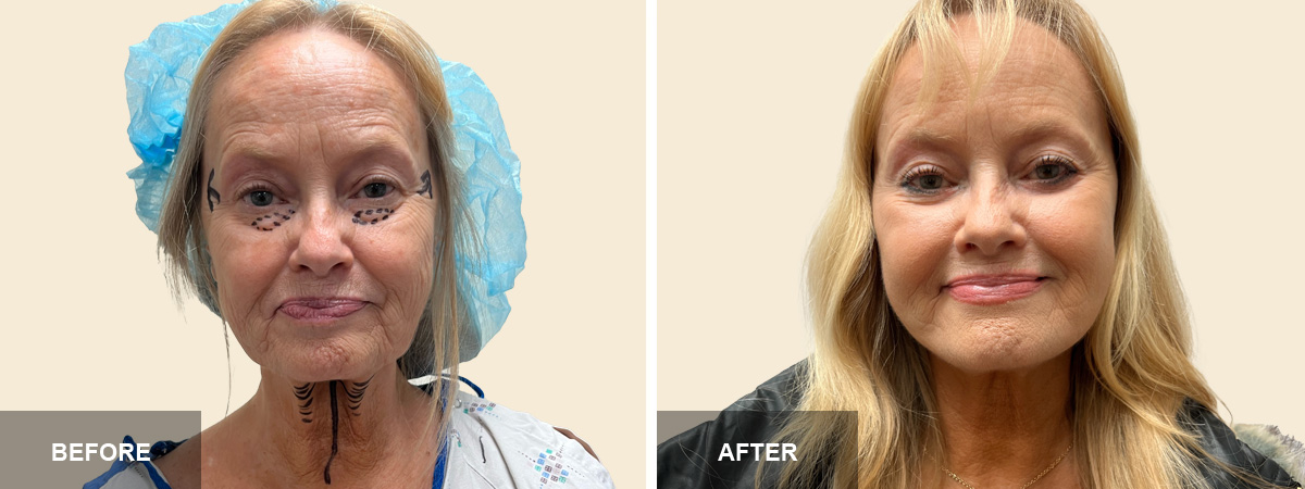 Gallery of Cosmetic Surgery | South Florida Center for Cosmetic Surgery